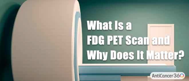 What Is A FDG PET Scan and Why Does It Matter?
